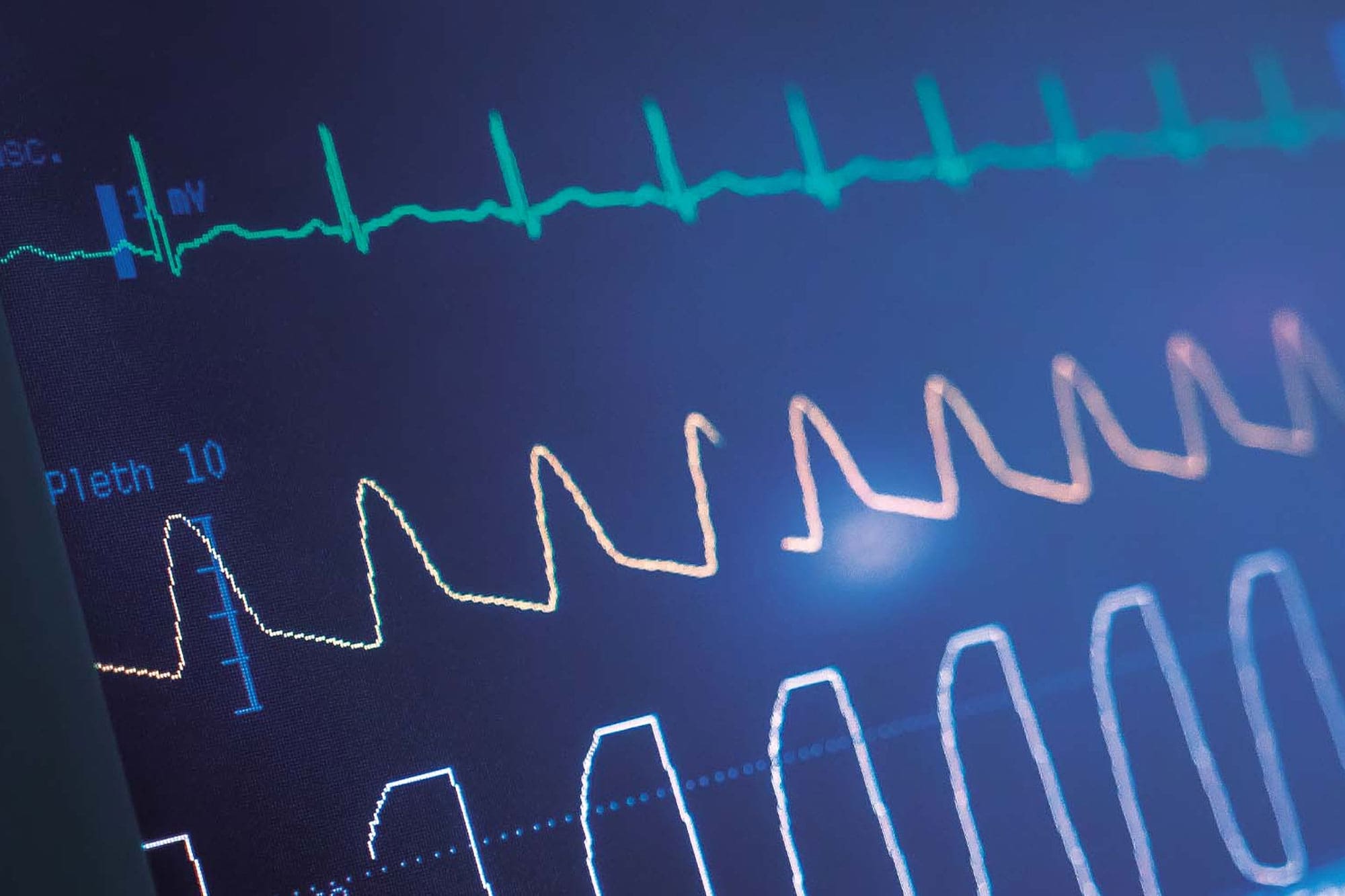 ECG Simulators - Calibration House